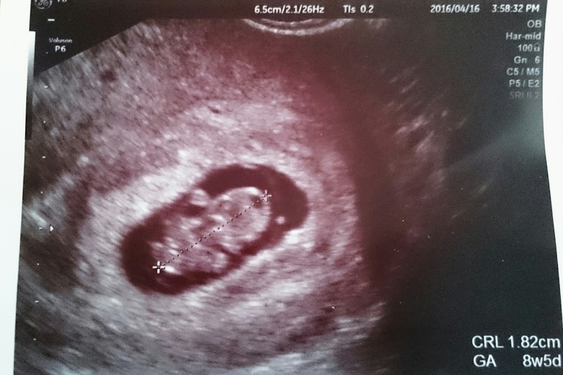 高温期44日目、8w5d、2回目の検診（エコー画像あり） - 小さいわが子へ、今度は元気な産声を聞かせてね